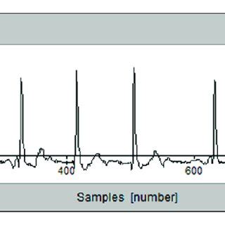 Graph Of Original ECG Signal Download Scientific Diagram
