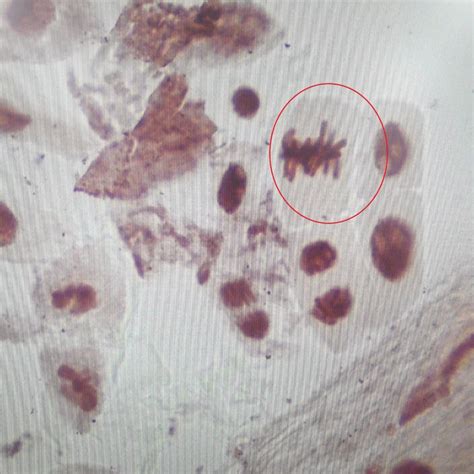 일반생물학 실험 3 호밀이삭세포의 감수분열 관찰제1분열 제2분열 간기 전기 중기 후기 말기 네이버 블로그