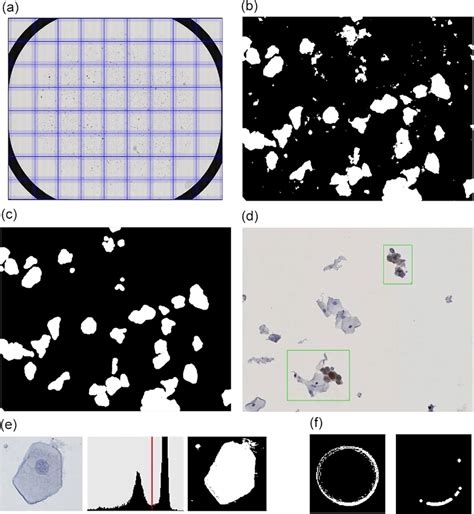 Illustration Of Object Detection A Virtual Slides Of 65000 × 50000