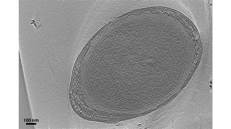 8 7 Monoderm Spores Atlas Of Bacterial And Archaeal Cell Structure