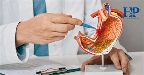 Va Secondary Conditions To Ibs Hill And Ponton Pa