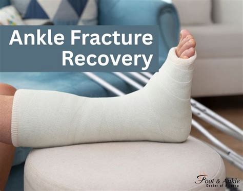 Ankle Fracture Recovery Diagnosis Treatment And Recovery