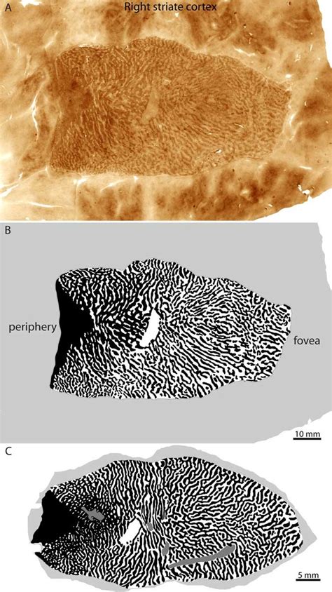 Comparison Of Ocular Dominance Columns In The Human And Macaque A Co