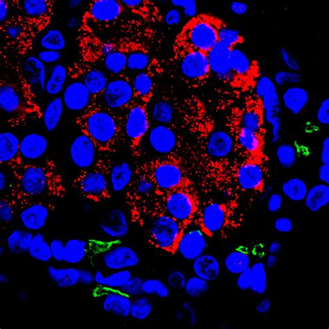 Human Pancreas On A Chip Opens New Possibilities For Studying Disease