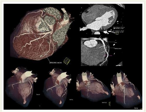 Figure 1 From Role Of Multimodality Cardiac Imaging In The Management