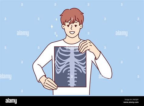 Man Applies X Ray Film To Chest To Prove Absence Of Cancerous Tumor Or