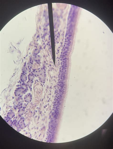 LABEX 7 Olfactory Epithelium Diagram Quizlet