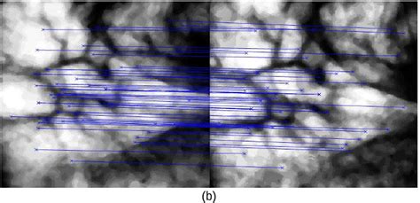 Pdf Palm Vein Recognition Using Scale Invariant Feature Transform