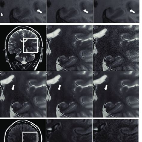 Activation Function Using Soft Shrinkage T Is The Threshold Of The Download Scientific Diagram