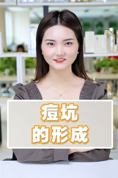 为什么会有痘坑？ 知乎