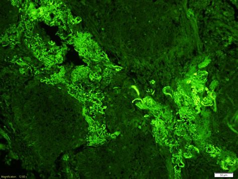 Fibrinogen Beta Chain Antibody Purified Rabbit Polyclonal Antibody