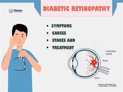 Diabetic Retinopathy Symptoms Causes Stages And Treatment