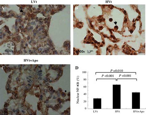 Apocynin decreased NF κB activation Nuclear staining of NF κB in lung Download Scientific