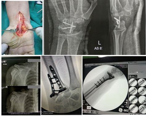 Dr Akram Jawed Hand Surgeon Gurgaon