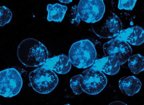 A Field Guide To Mapping The Tumor Microenvironment With Spatial