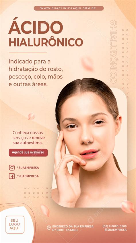 Post Story Clínica Ácido Hialurônico Social Media Psd Editável Ácidos