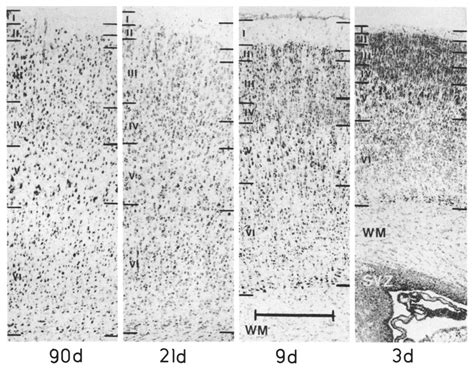 Development Of The Cortical Layers I Vi Between Postnatal Days 3 And 90 Download Scientific