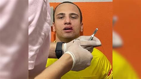 Treinador De Goleiros Agride árbitro Assistente Durante Partida Veja Vídeo