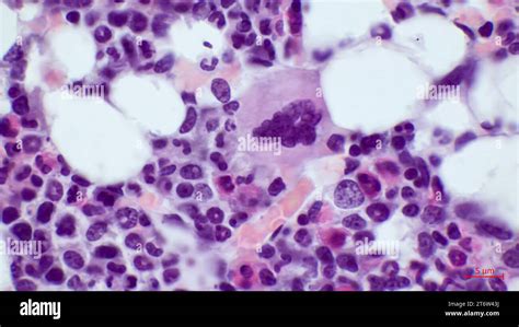 The Largest Cell In The Red Bone Marrow Is The Megakaryocyte Located