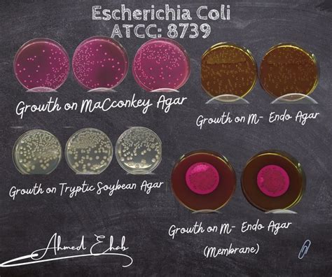 Ahmed Ehab Salah On Linkedin Growth Of Escherichia Coli Atcc 8739 On