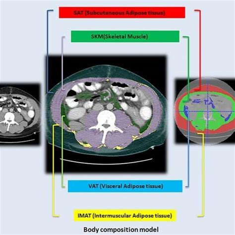 Listen To An Audio Version Of A Pressrelease About The Research Paper Computed Tomography