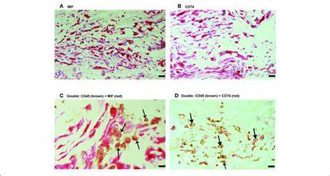 Characterization Of Macrophage Migration Inhibitory Factor Mif And