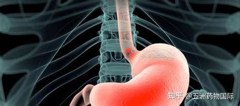 一文带你了解抗胃酸反流的“黑科技”——海藻酸钠 知乎