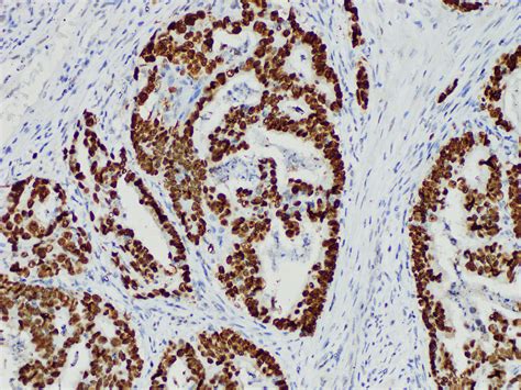 Antibodies