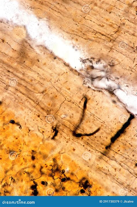 Cerebellar Cortex Parallel Fibers Stock Image Image Of Neuroscience Layer 291730379