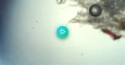 Strawberry Chromatin Under A Microscope Album On Imgur