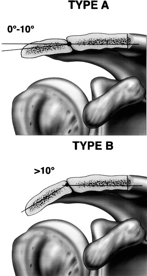 Acromioclavicular Joint Structure Semantic Scholar