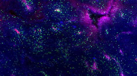 Rewired Mitochondria To Help The Immune System Fight Cancer Advanced