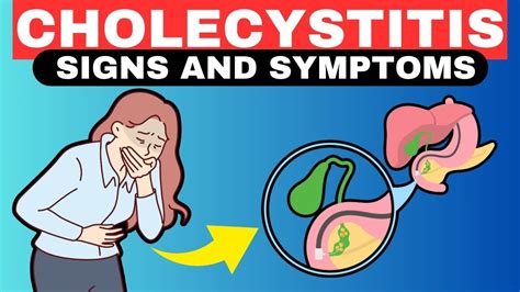 Top 10 Warning Signs And Symptoms You Might Have Cholecystitis YouTube