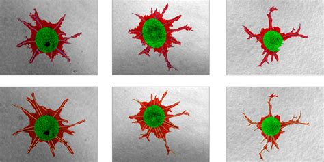 Quantification Of Angiogenesis Zib De