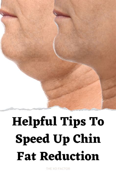 Helpful Tips To Speed Up Chin Fat Reduction The XO Factor