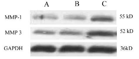 Western Blot Of Mmp 1 And Mmp 3 Protein Expression Compared With