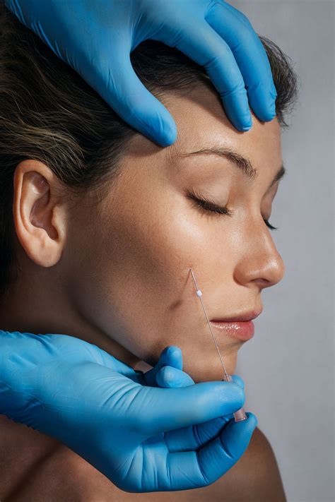 Dermal Fillers Medford Or Rogue Revitalize