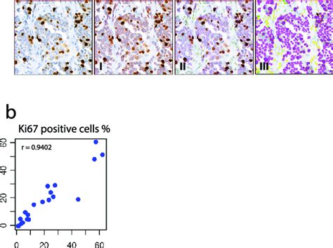Automated Ki67 Scoring By Artificial Intelligence A Image Analysis Download Scientific Diagram