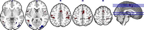 Figure 2 1 From Consensus Clustering Framework For Analysing Fmri