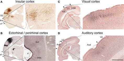 Frontiers Brain Wide Map Of Efferent Projections From Rat Barrel Cortex