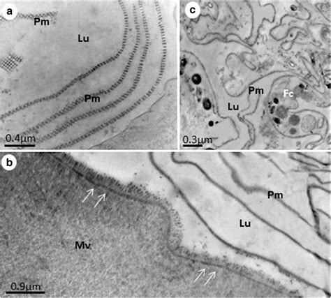 Transmission Electronic Micrographs Of The Peritrophic Membrane From