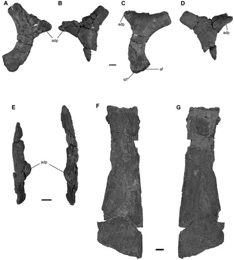 A Lateral View Of The Right Ilium B Lateral View Of The Left Ilium