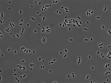 Scientists Identify Possible New Transmission Factor In Hospital