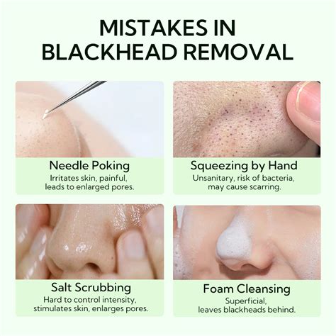 Lanbena Blackheads Removal Serum Blackhead Remover Mask Nose Strip Deep