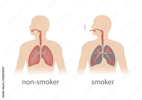 Smoker And Non Smoker Lungs Comparison Vector Format Stock Vector