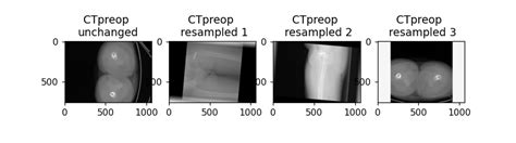 Simpleitk Euler D Transform Problem With Output Size Resampling