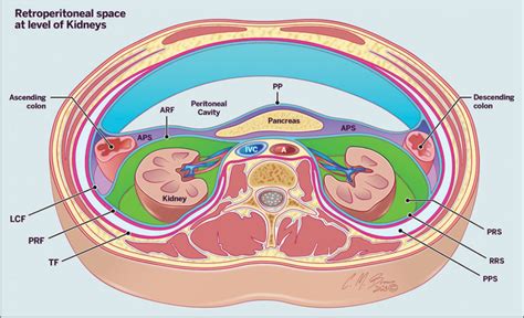 Retroperitoneal Cancer An In Depth Overview