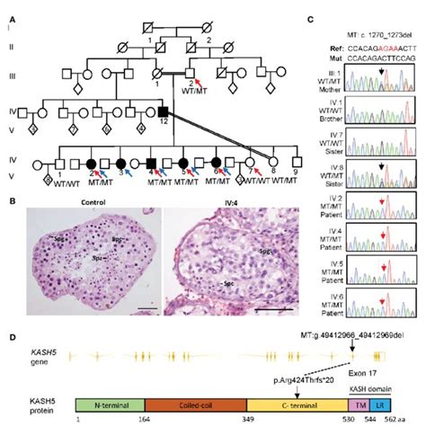 A Homozygous Kash5 Mutation Was Identified From Pakistani Patients