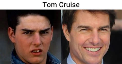 ¡cuánta Razón Arreglarse Los Dientes Les Sentó Muy Bien