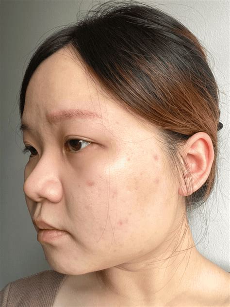 Ap Lotion Challenge Coslab Beauty Spa